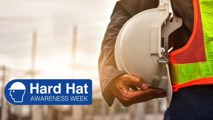 Workplace Head Injuries: Prevention, Response & Legal Rights | Express ...